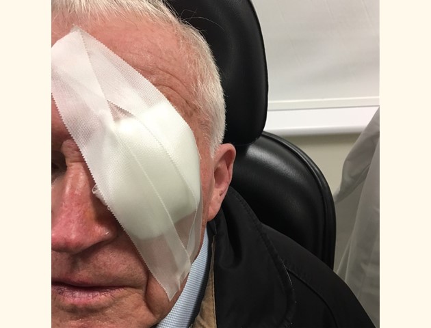 Eyelids that are turning inwards